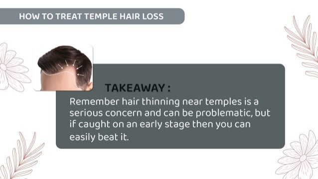 Hair Loss On Temples Causes And Treatments Ppt