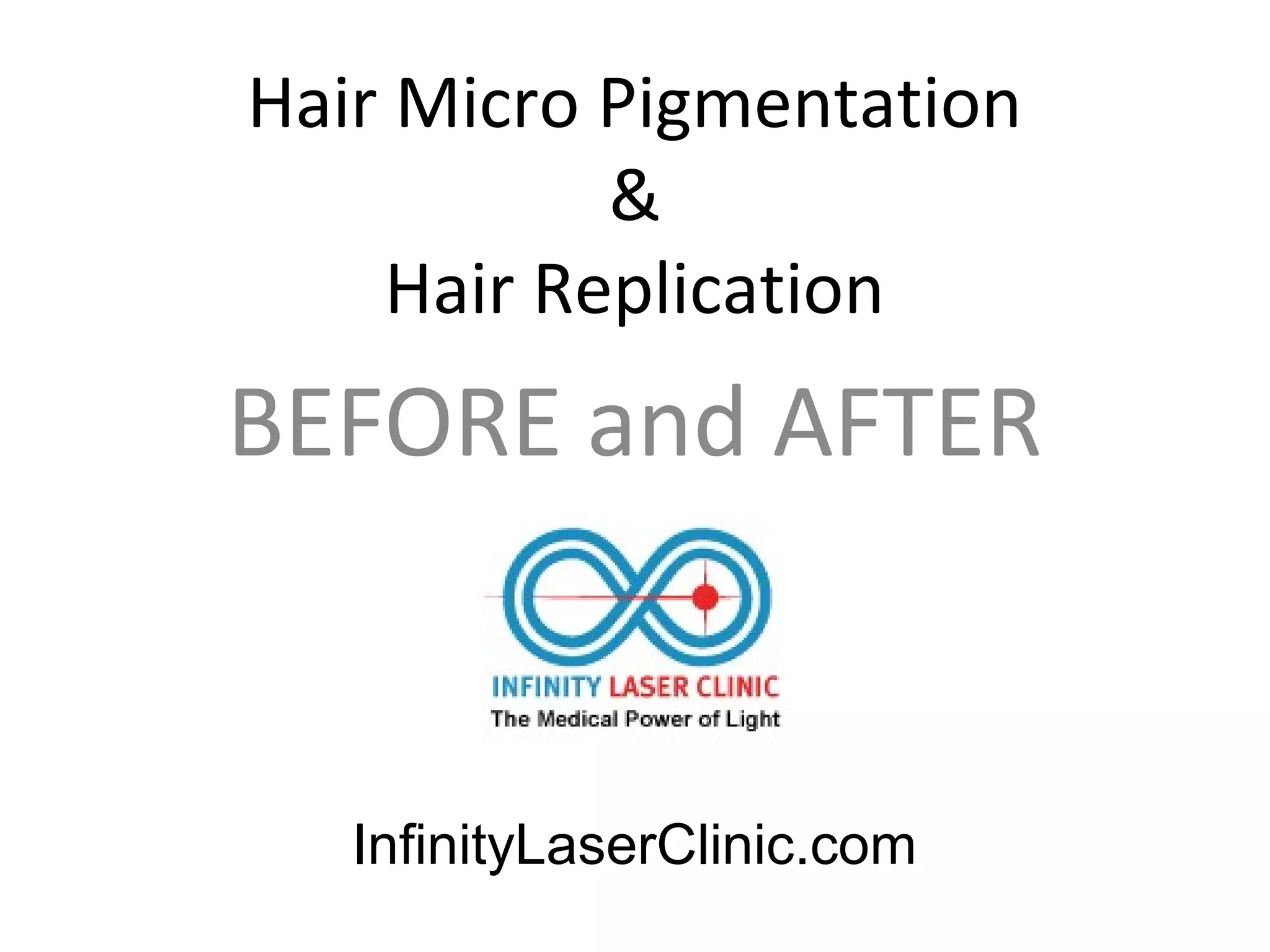 Hair pigmentation | PPT