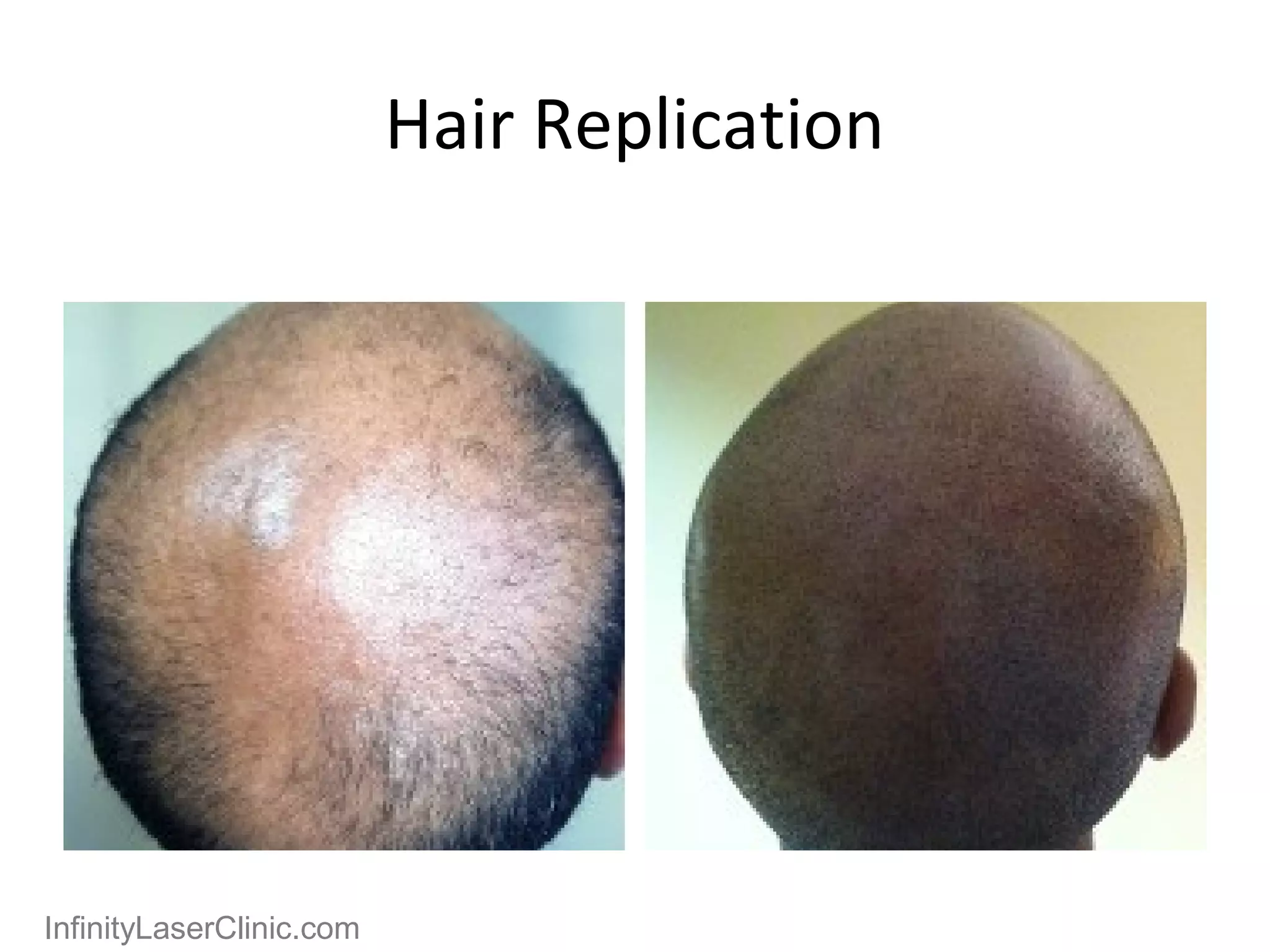 Hair pigmentation | PPT