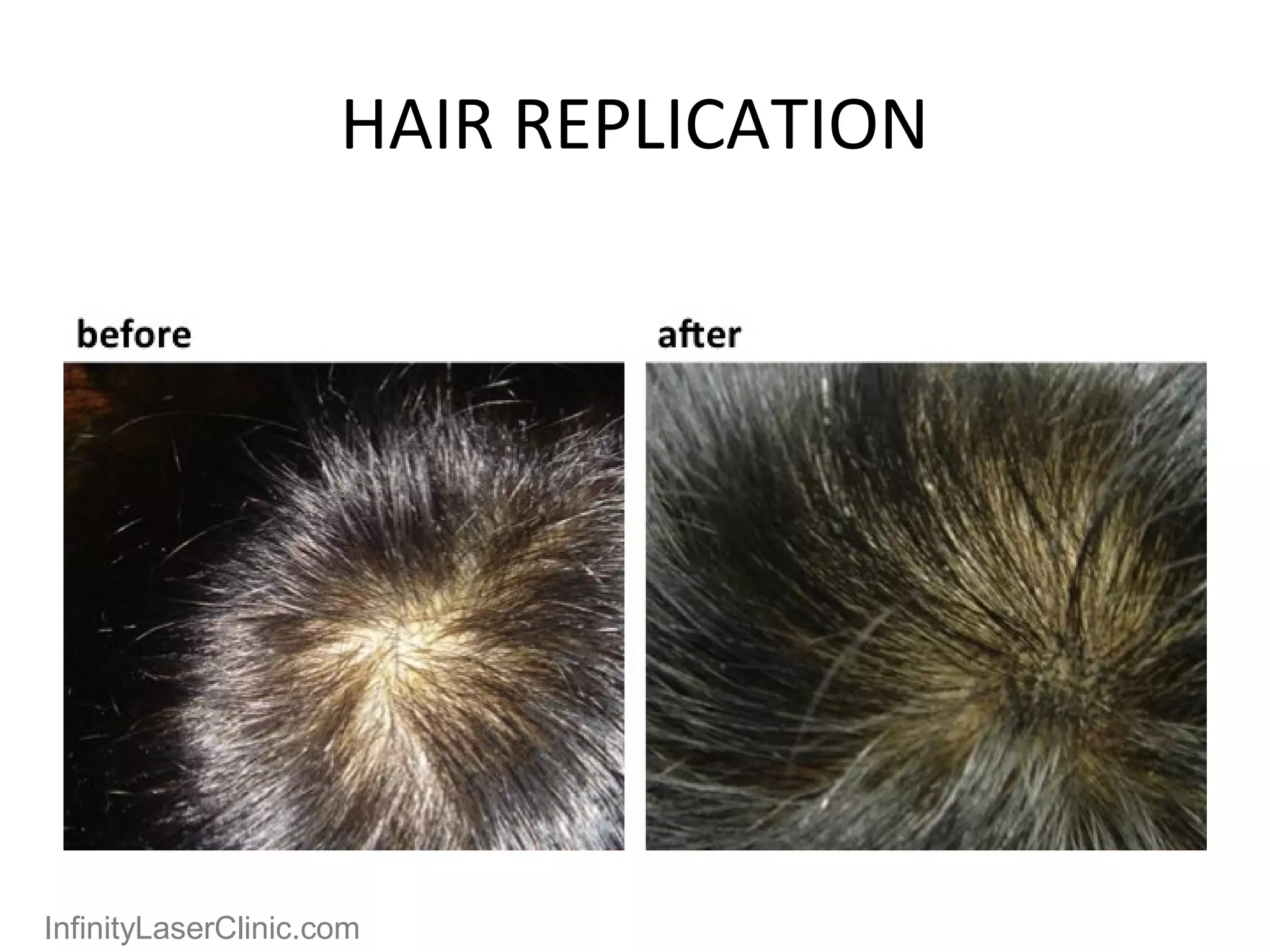 Hair pigmentation | PPT