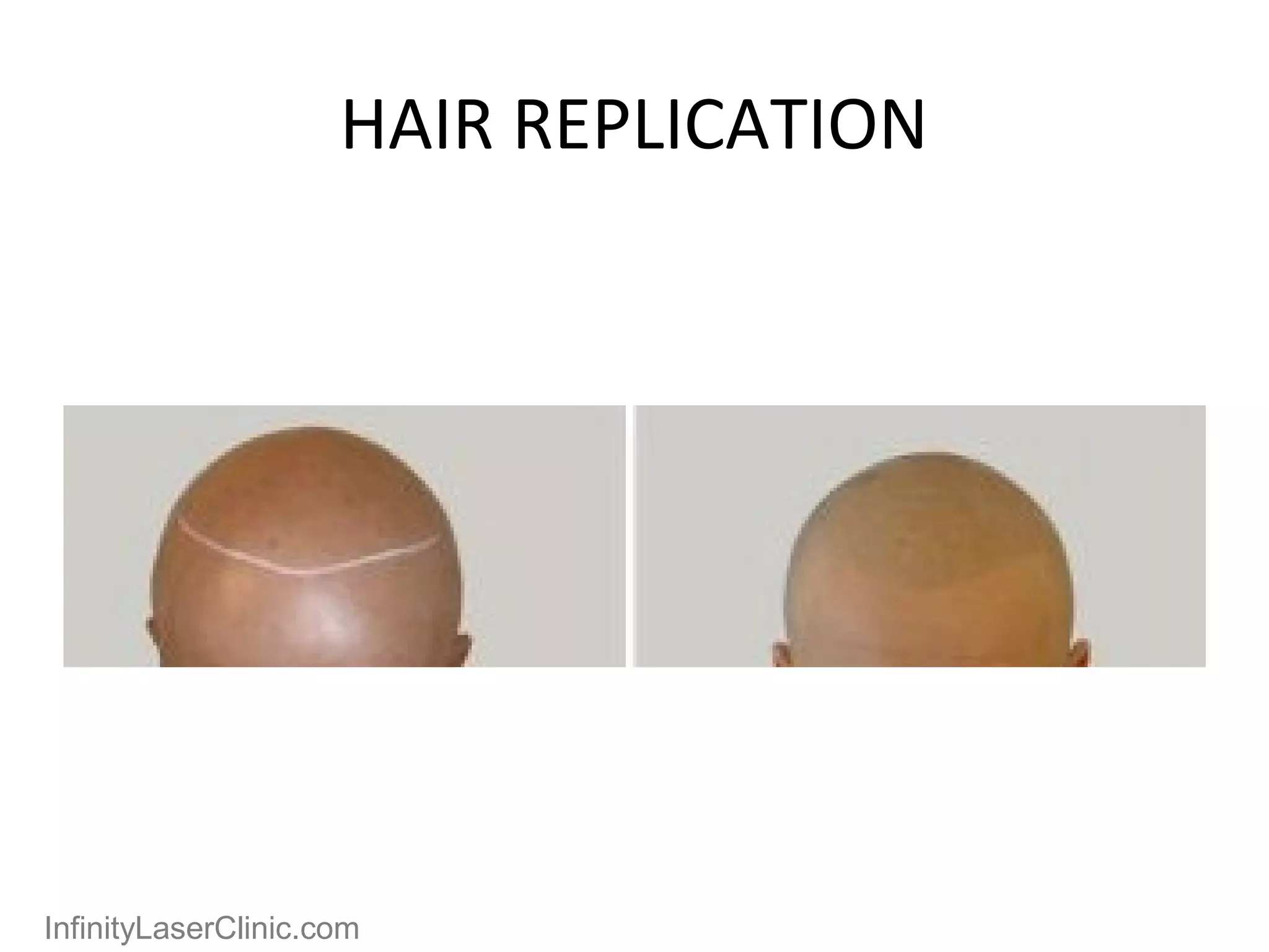 Hair pigmentation | PPT