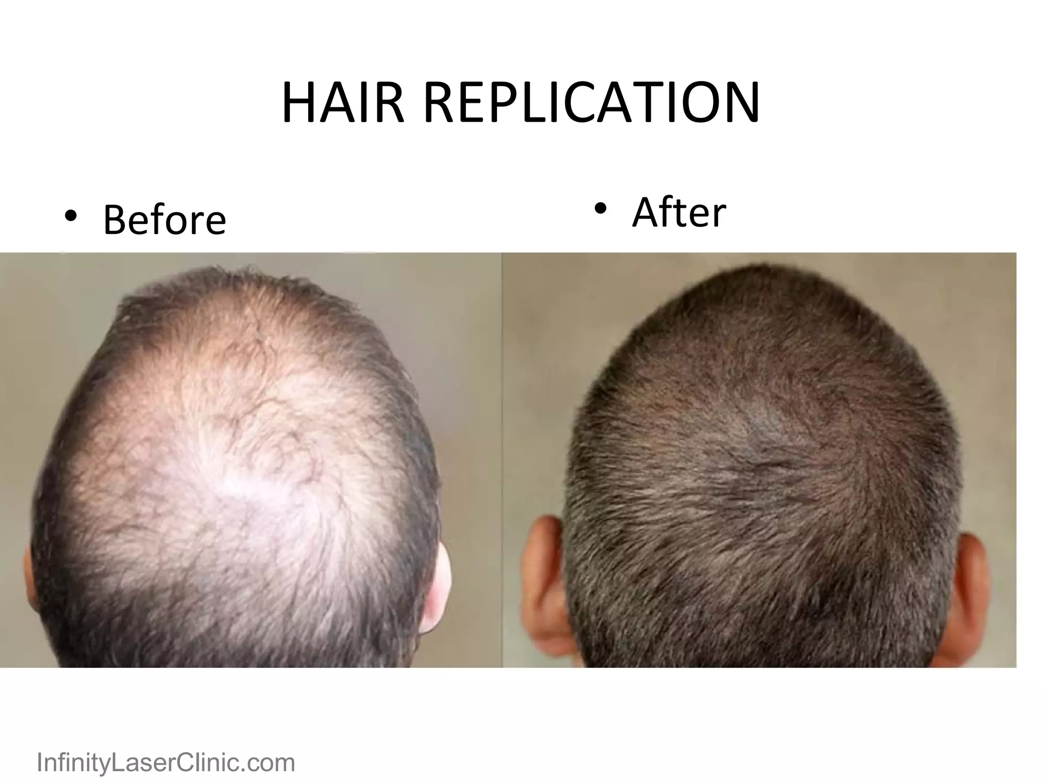 Hair pigmentation | PPT