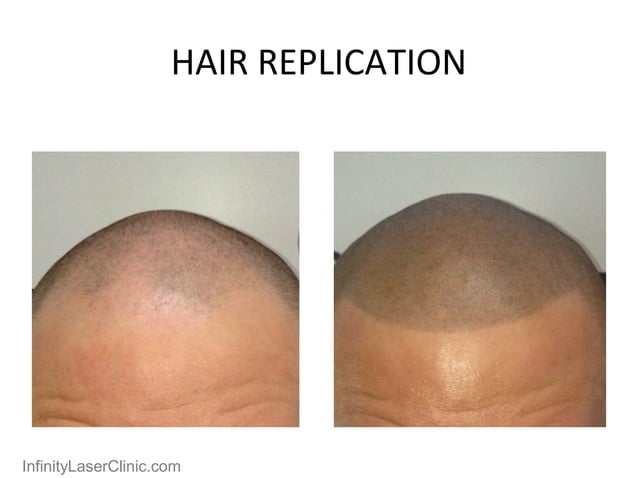 Hair pigmentation | PPT