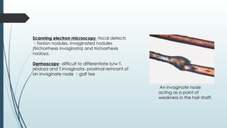 Dermatology based HAIR SHAFT DEFECTS.pptx