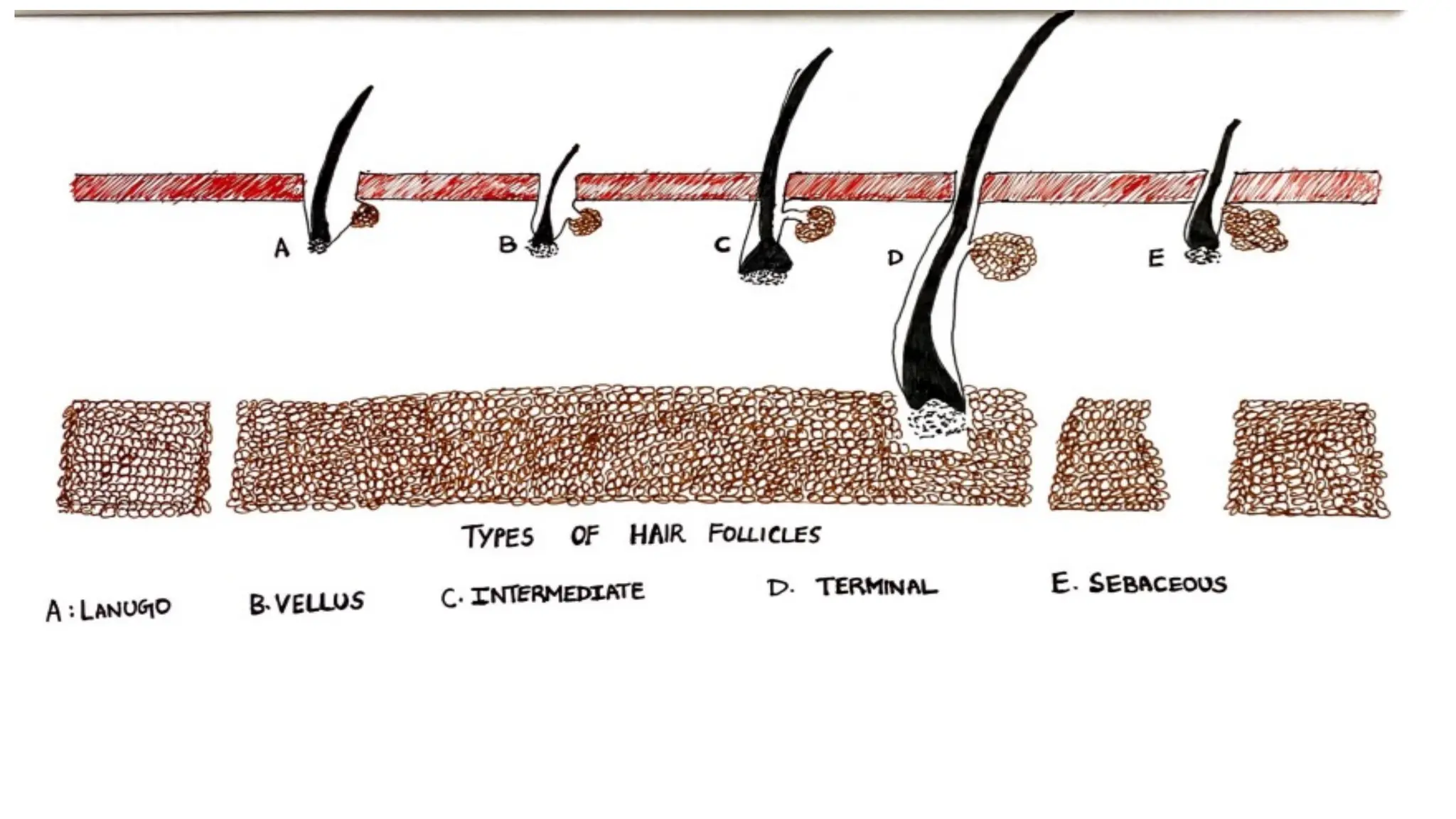 An Approach To Hair Shaft Disorders In Dermatology Ppt