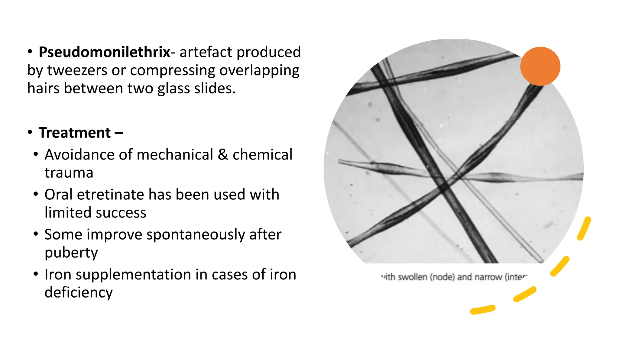 An approach to hair shaft disorders in Dermatology | PDF