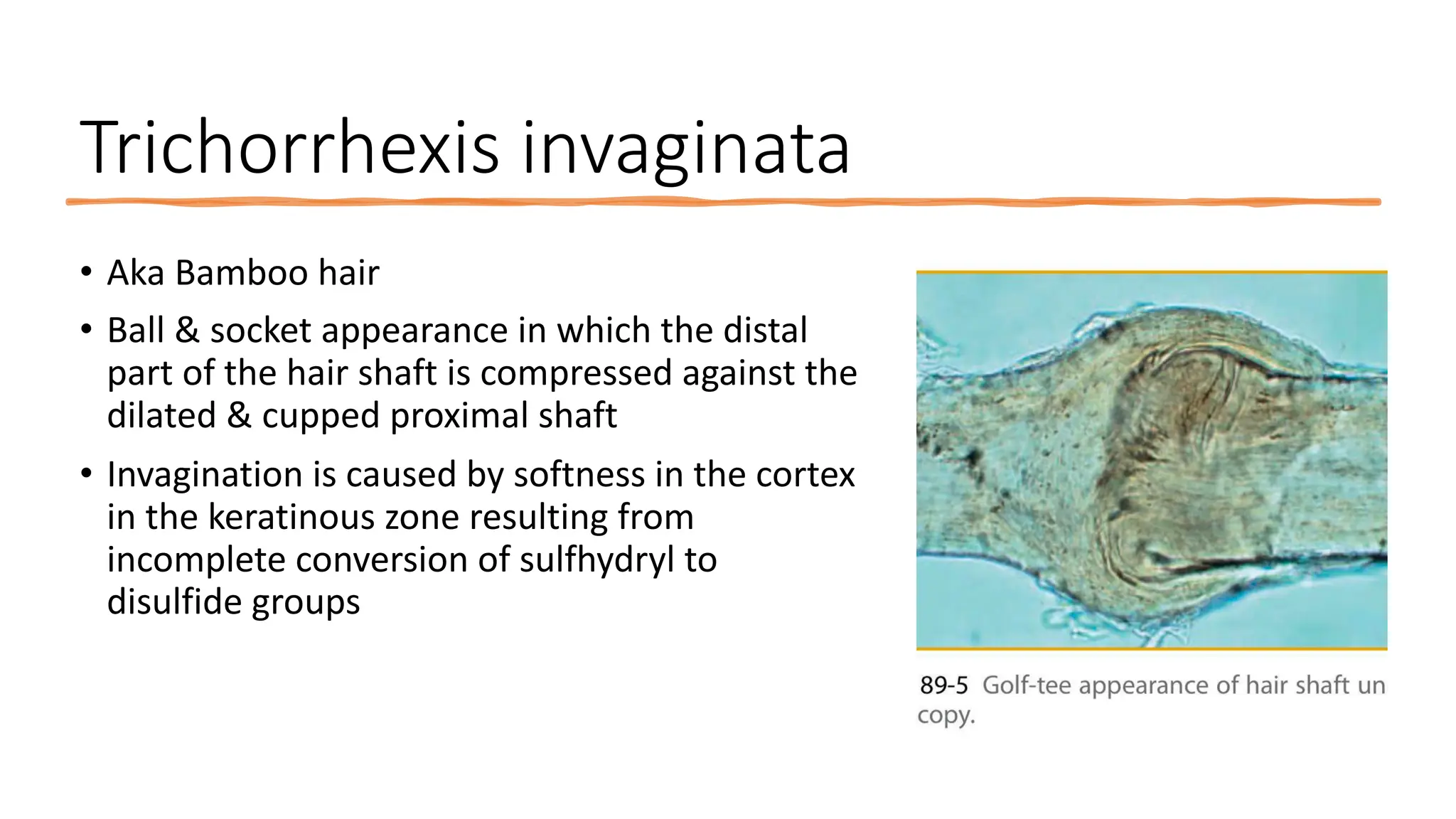 An approach to hair shaft disorders in Dermatology | PDF