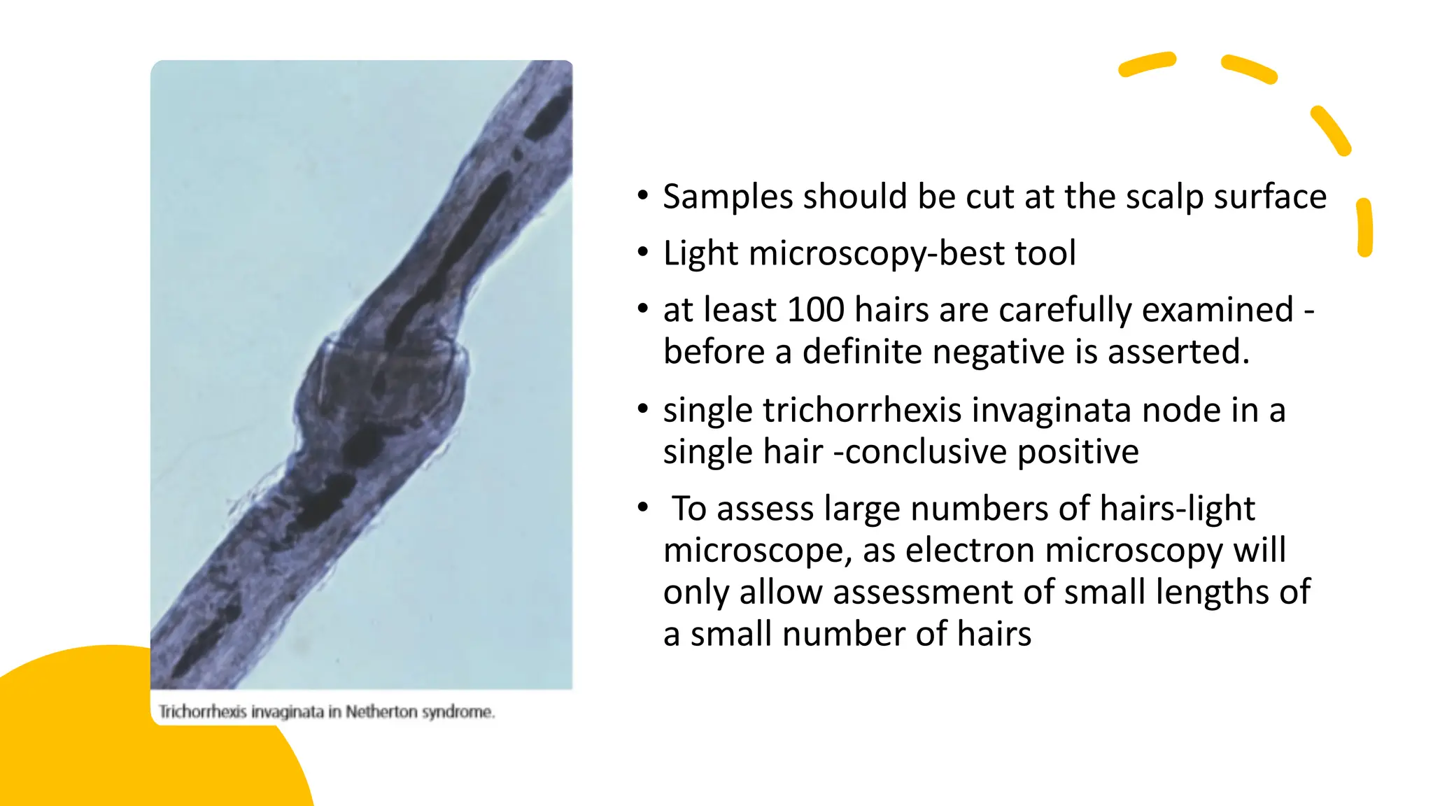 An approach to hair shaft disorders in Dermatology | PDF