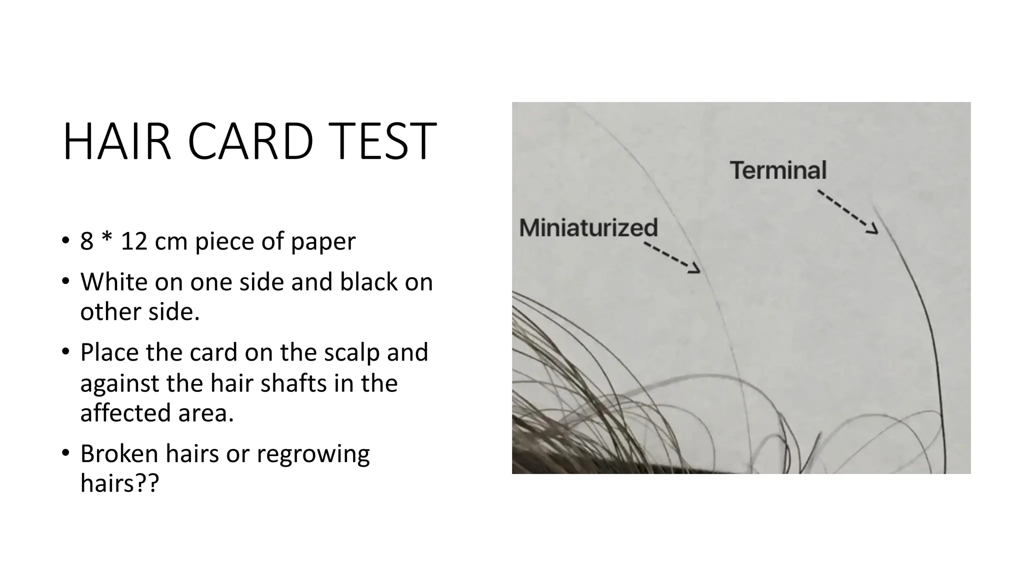 An approach to hair shaft disorders in Dermatology | PDF