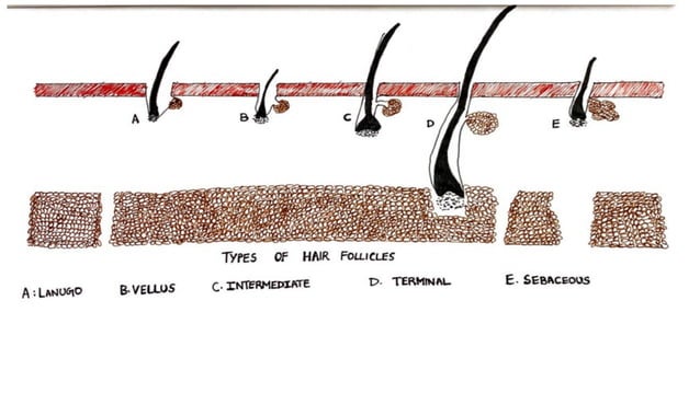 An approach to hair shaft disorders in Dermatology | PDF
