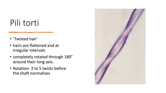 An approach to hair shaft disorders in Dermatology | PDF