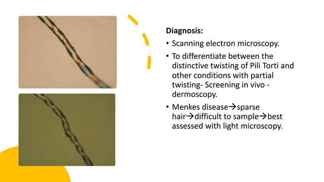 An approach to hair shaft disorders in Dermatology | PDF