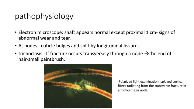 An approach to hair shaft disorders in Dermatology | PDF