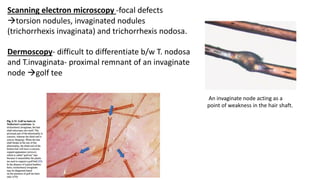 An approach to hair shaft disorders in Dermatology | PDF