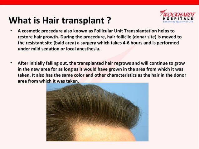 Hair transplant | PPT