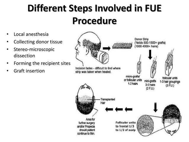 Stages of FUE Process | PPT