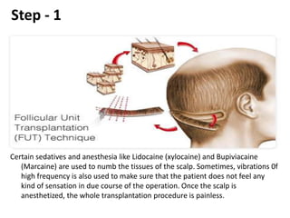 Stages of FUE Process | PPT