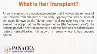 Hair Transplant Clinic in Delhi (1).pptx