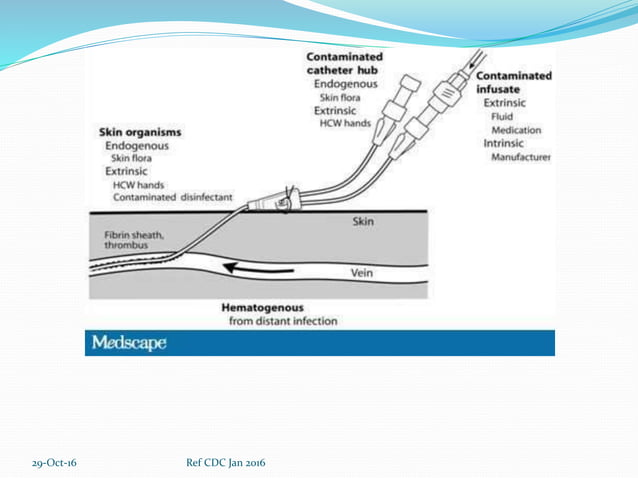central line related blood stream infection | PPT