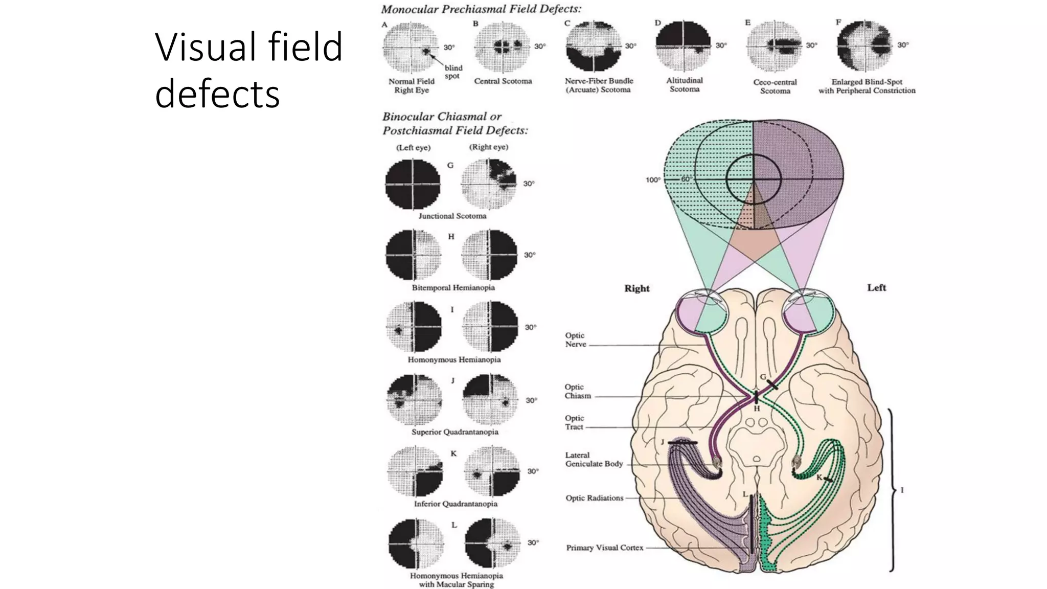 Haitham's Ophthalmology Board Exam Revision- part 2 | PPT