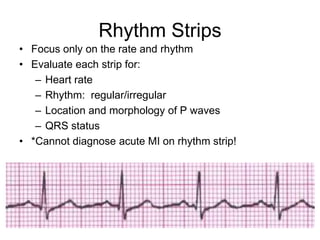 Basic EKG and Rhythm Interpretation Symposia - The CRUDEM Foundation | PPTX