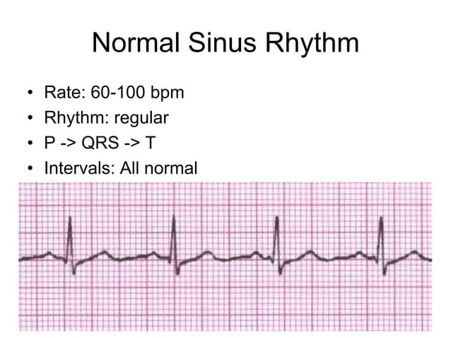 Basic EKG and Rhythm Interpretation Symposia - The CRUDEM Foundation