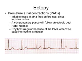 Basic EKG and Rhythm Interpretation Symposia - The CRUDEM Foundation | PPT