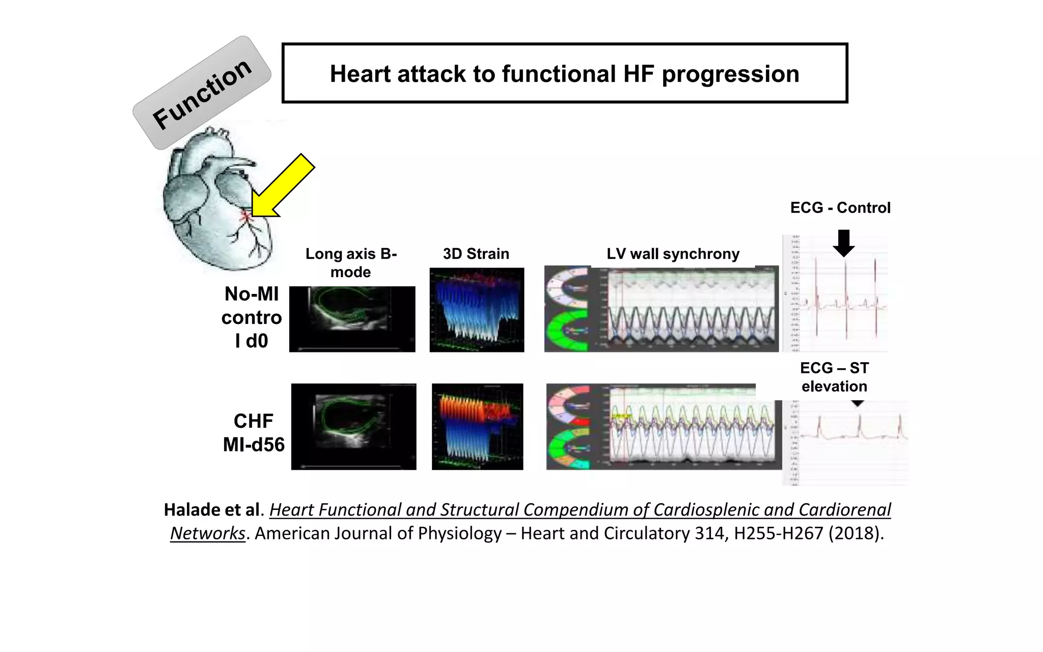 Inflammation and the Resolution of Inflammation in Heart Failure ...