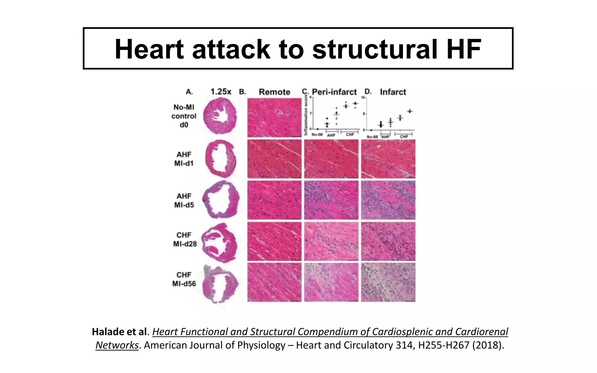 Inflammation and the Resolution of Inflammation in Heart Failure ...