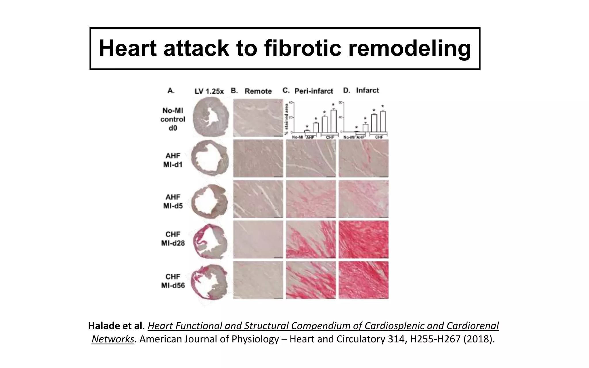 Inflammation and the Resolution of Inflammation in Heart Failure ...