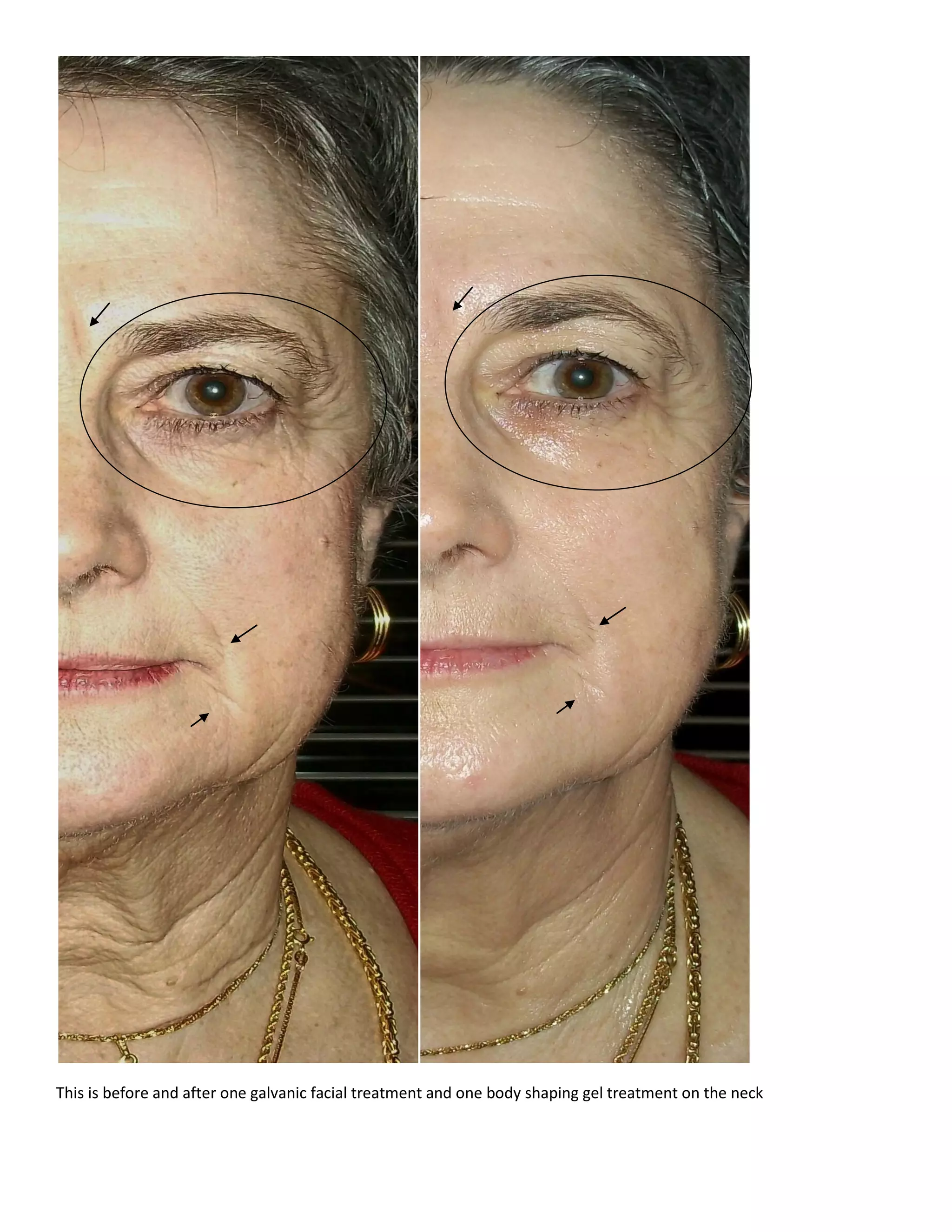 Half Face Before And After | PDF