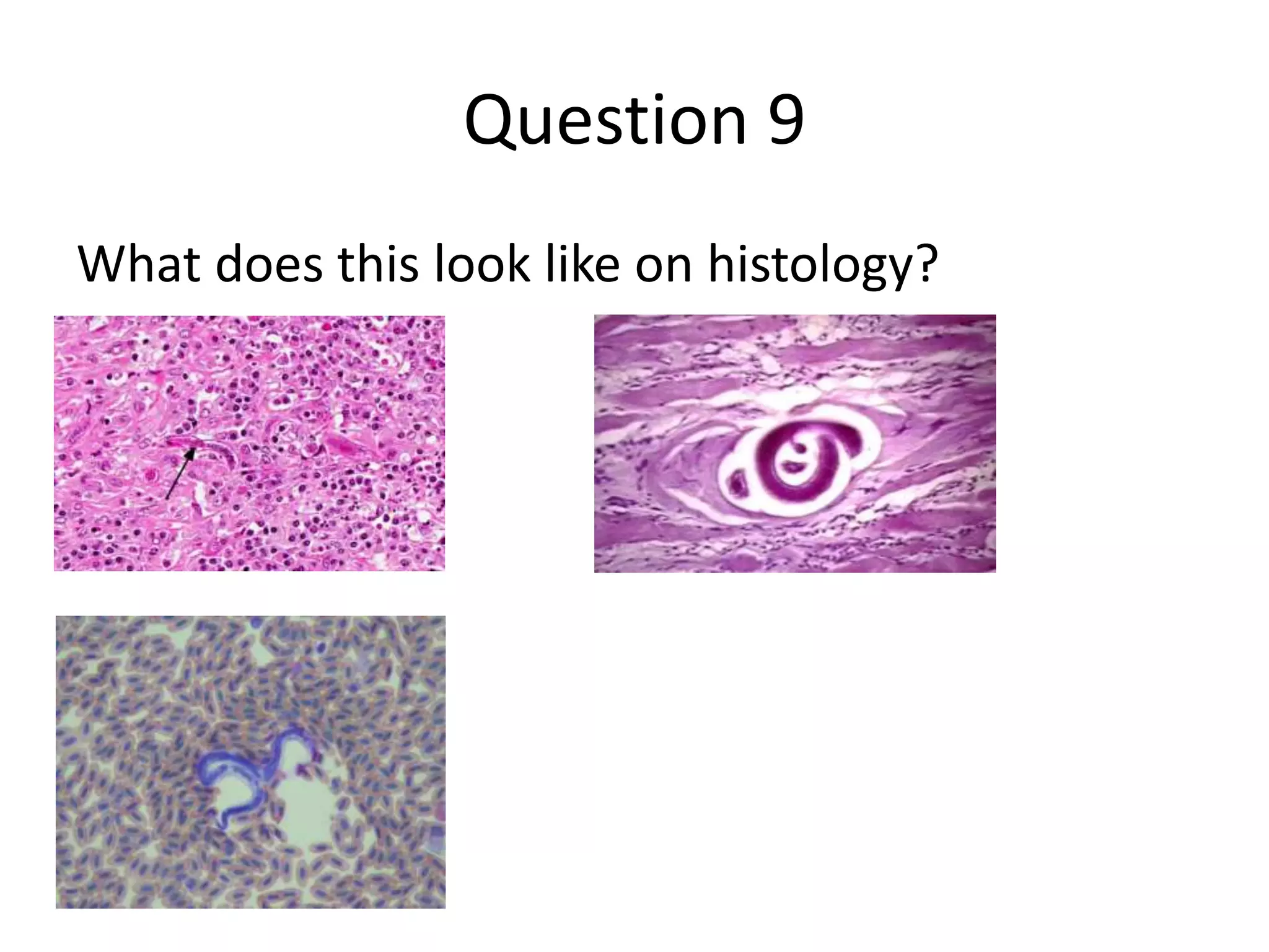 Halicephalobus gingivalis | PPT