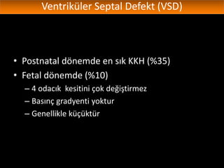 ASD,AVSD ,VSD | PPT