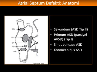 ASD,AVSD ,VSD | PPT