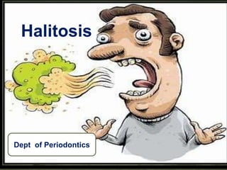 Haliotosis | PPTX