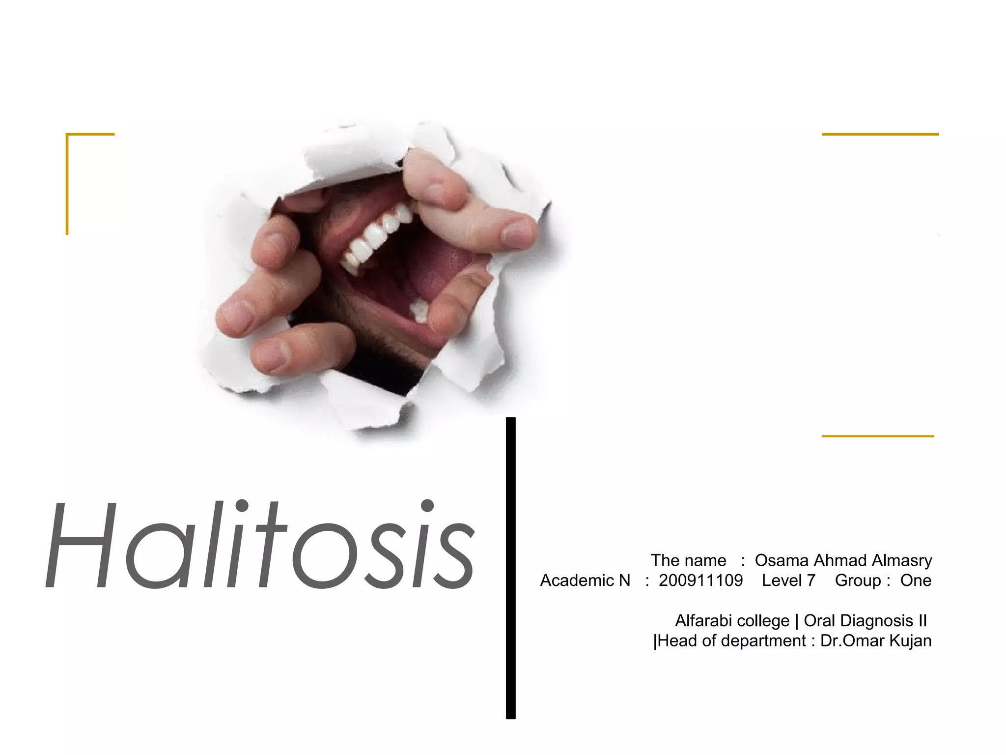 Halitosis | PPT