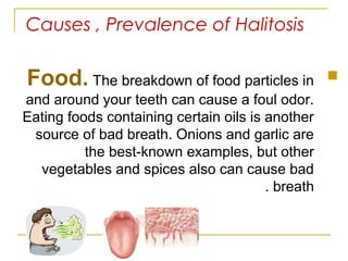 Halitosis | PPT