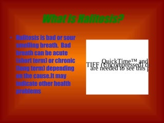 Halitosis | PPT