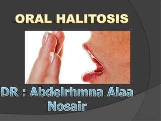 Halitosis | PDF