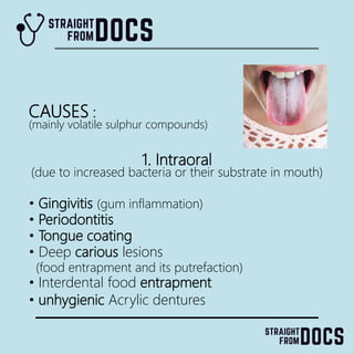 Halitosis | PPTX