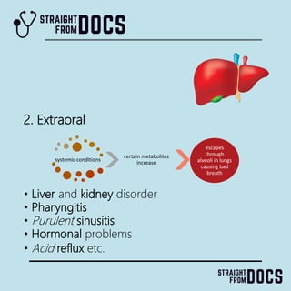 Halitosis | PPTX | Dental Health | Diseases and Conditions