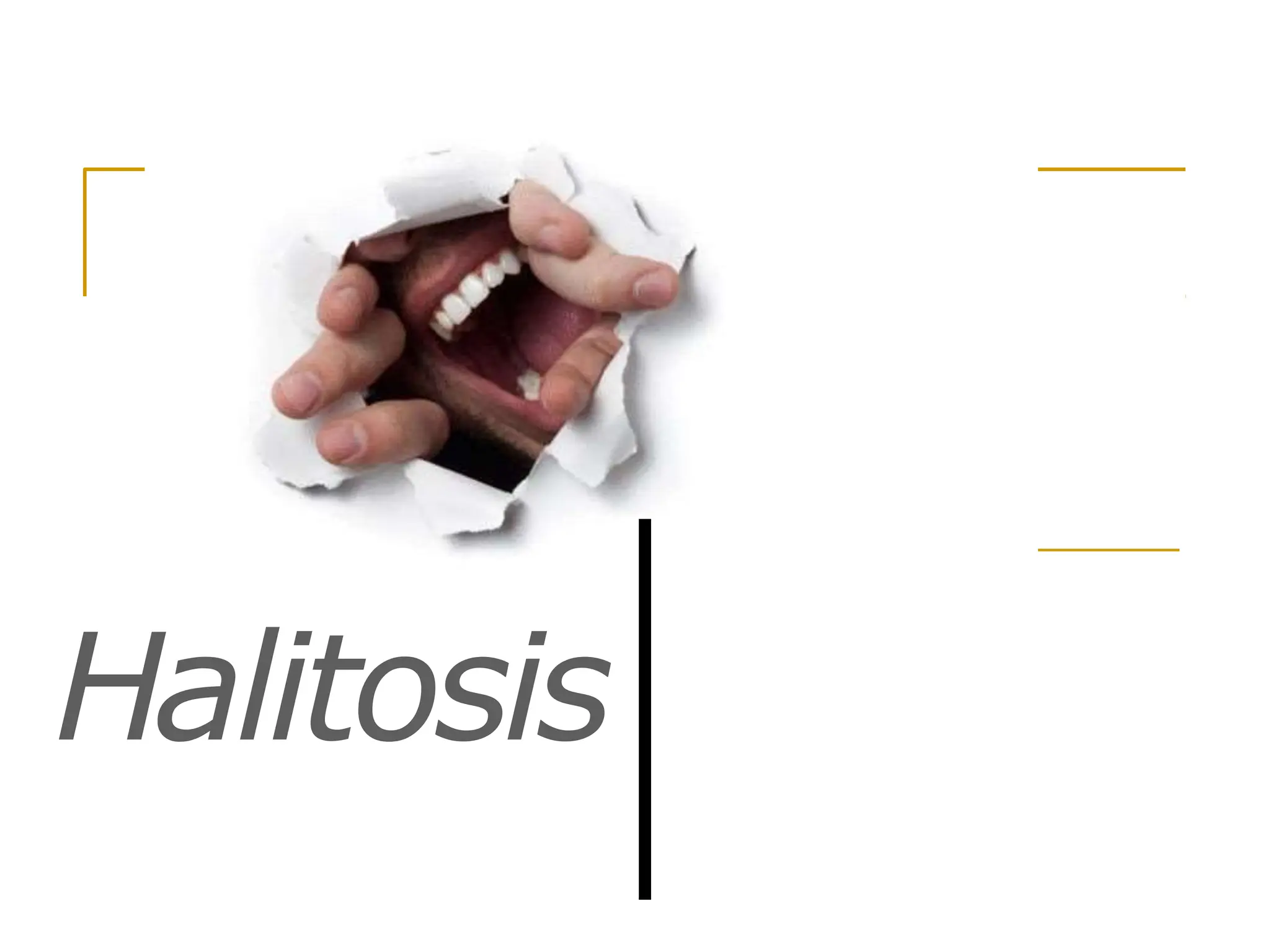 HALITOSIS.pptx