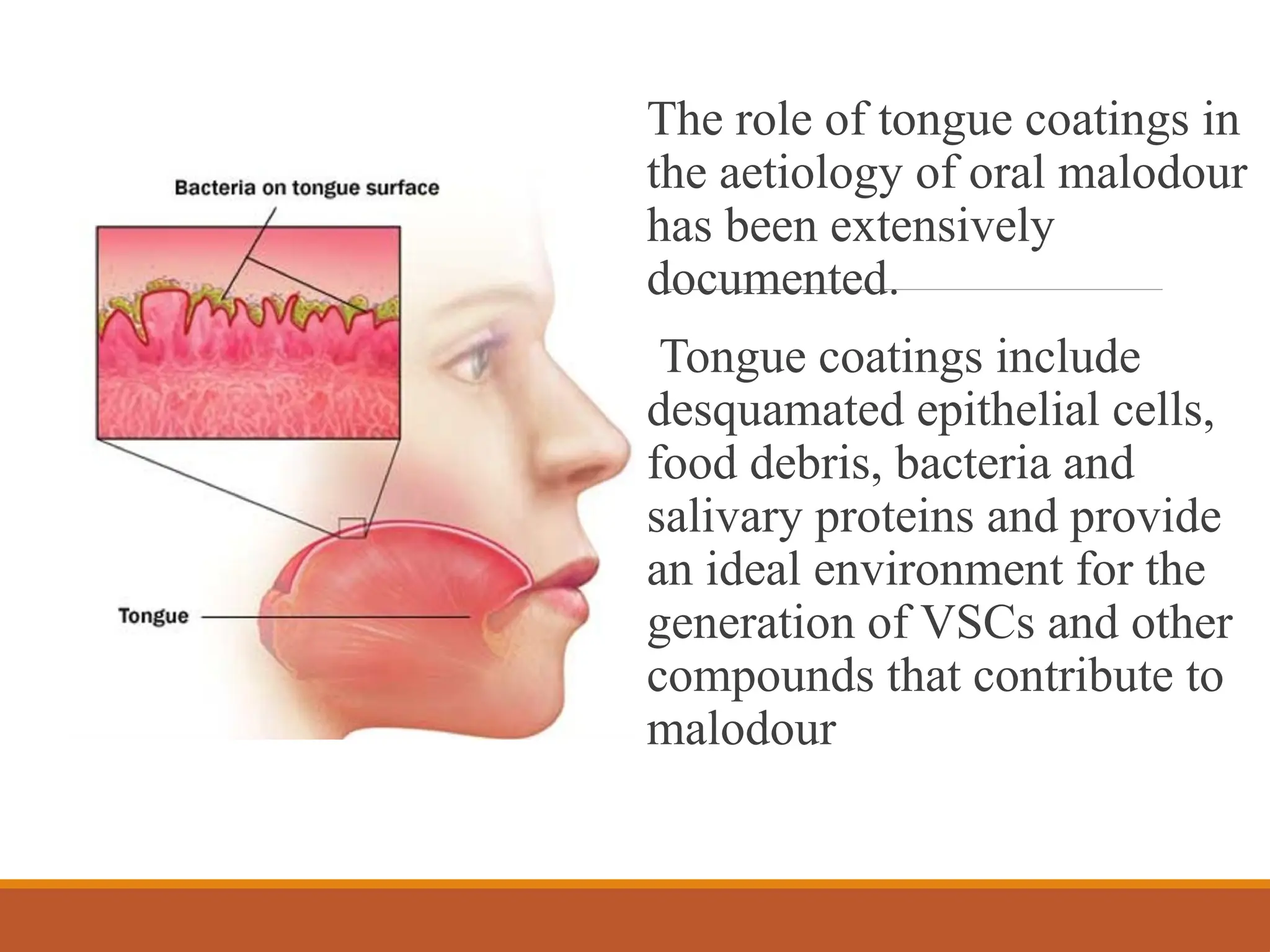 halitosis.pptx Halitosis periodontology carranza | PPTX
