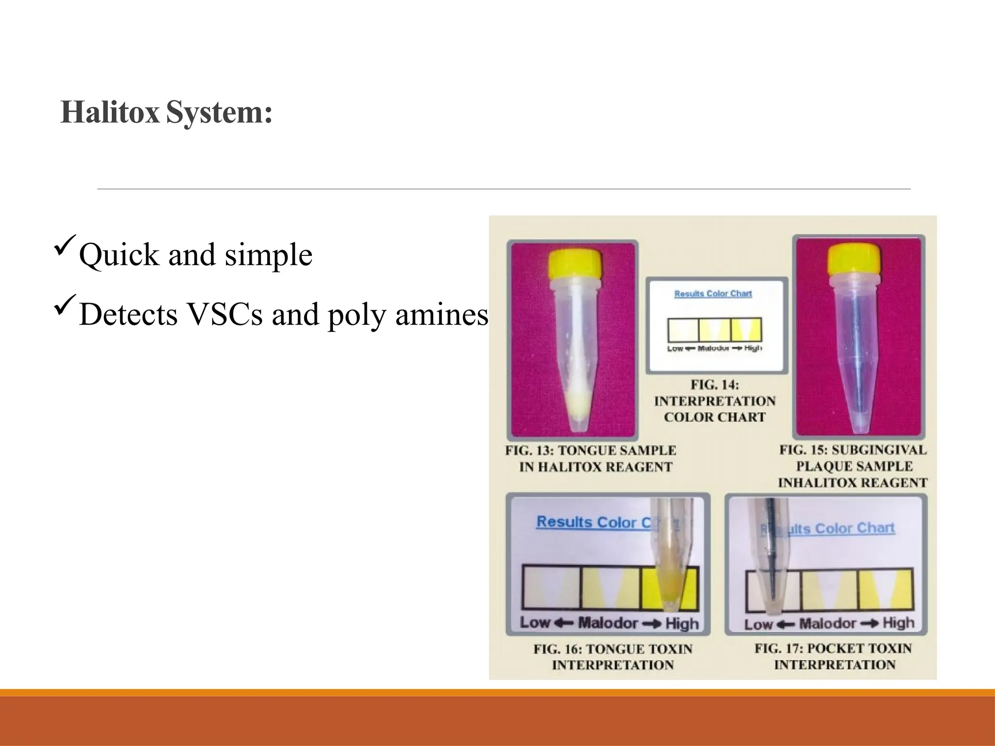 halitosis.pptx Halitosis periodontology carranza | PPTX