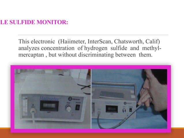halitosis.pptx Halitosis periodontology carranza | PPTX