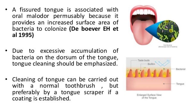 Halitosis ppt