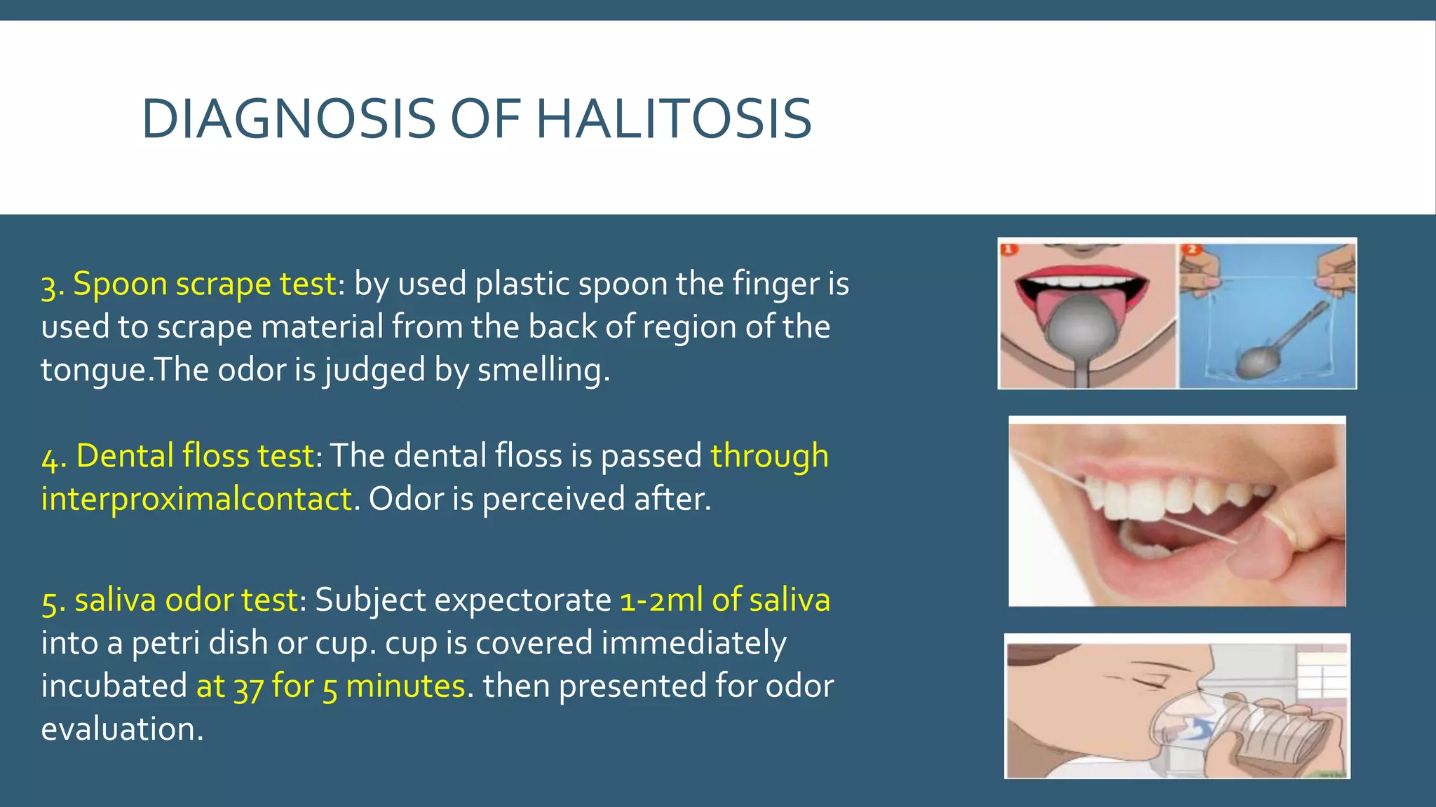 Halitosis - bad breath presentation | PPTX