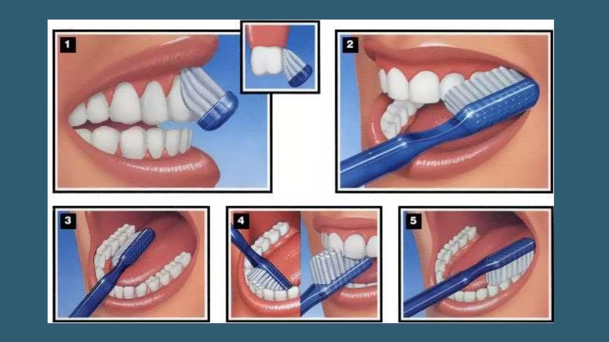 Halitosis - bad breath presentation | PPTX
