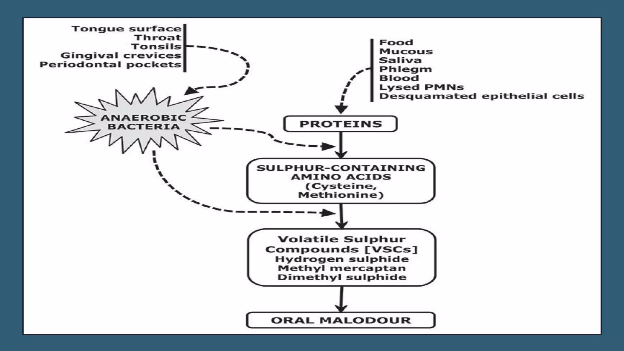 Halitosis - bad breath presentation | PPTX