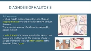 Halitosis - bad breath presentation | PPTX